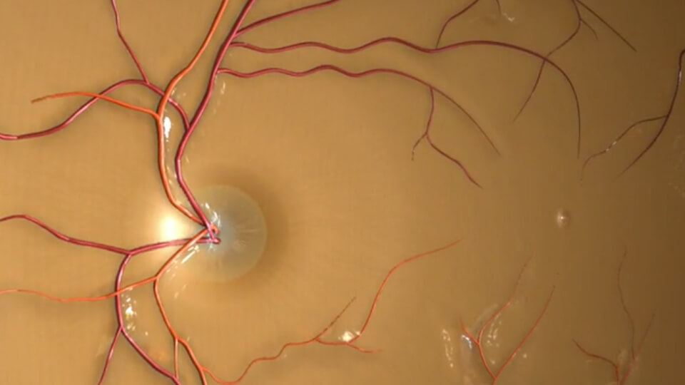 Eye Treatments Archive – Northpoint Eyecare