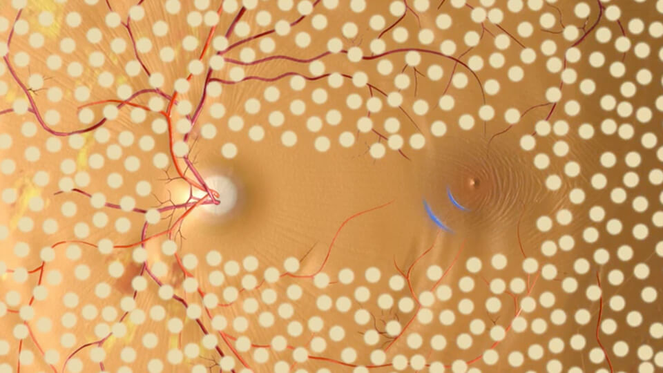 Eye Treatments Archive – Northpoint Eyecare