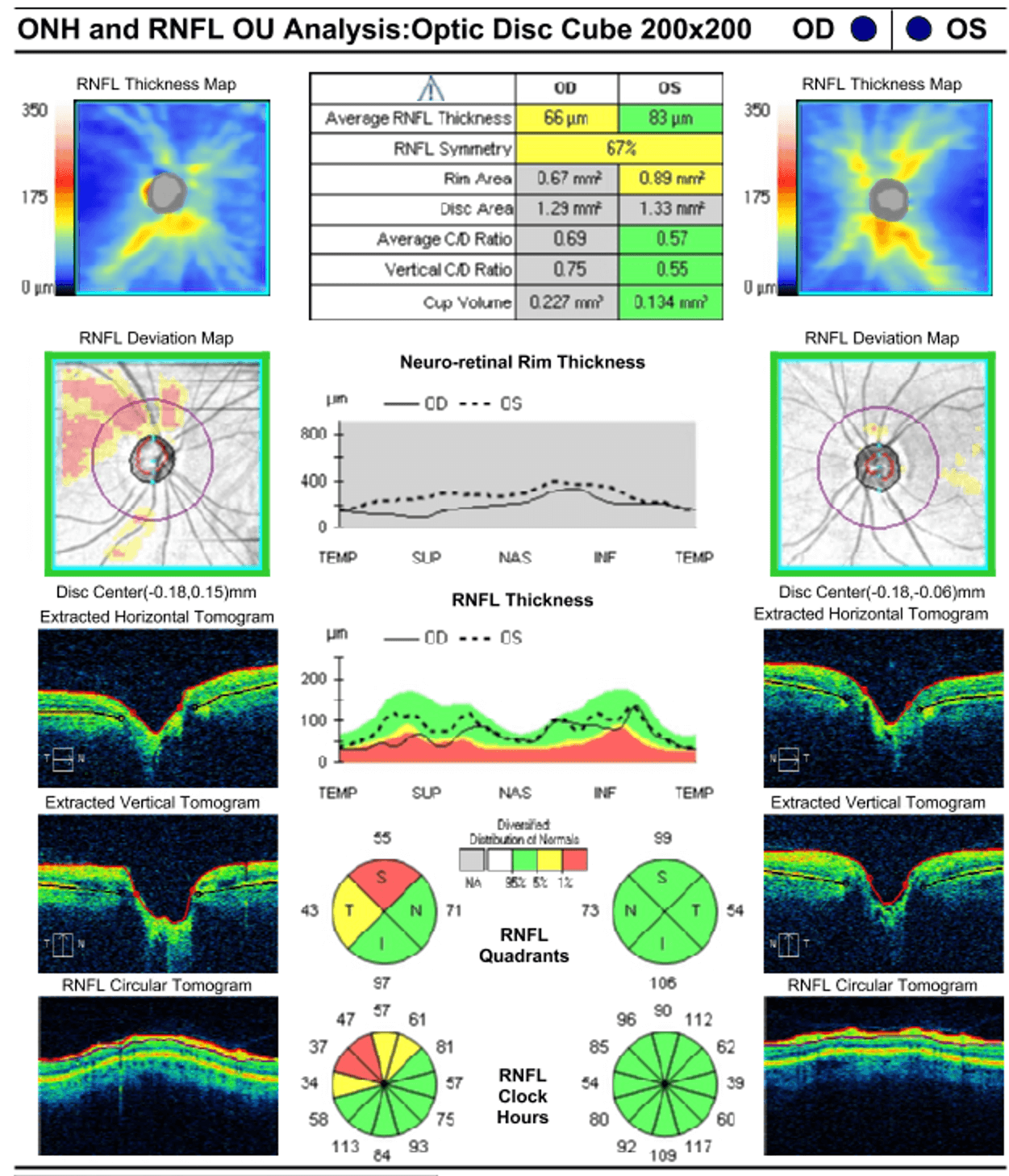 Patient Information – Northpoint Eyecare