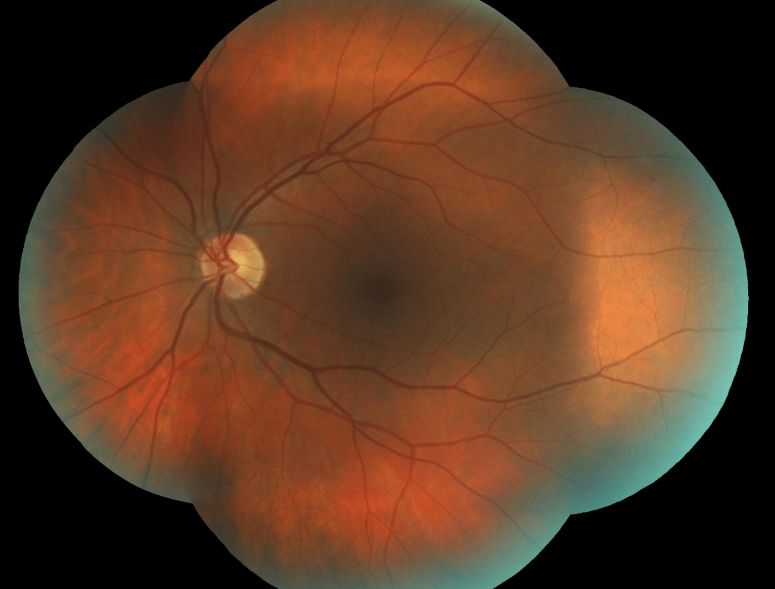 Patient Information – Northpoint Eyecare